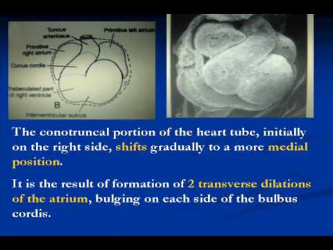CBNS169 Cardiac Loop Formation - YouTube