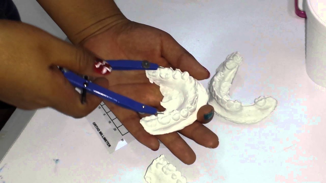 Analisis de Korkhaus - YouTube