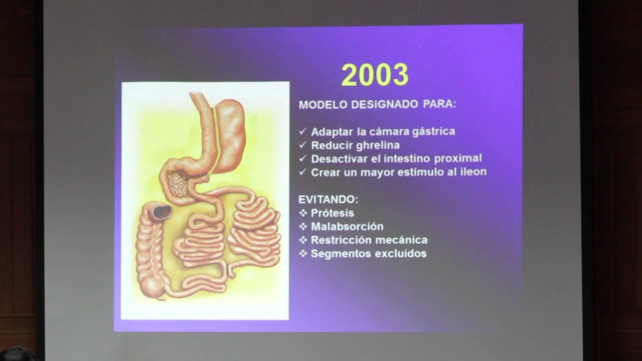 Bipartición Intestinal - YouTube