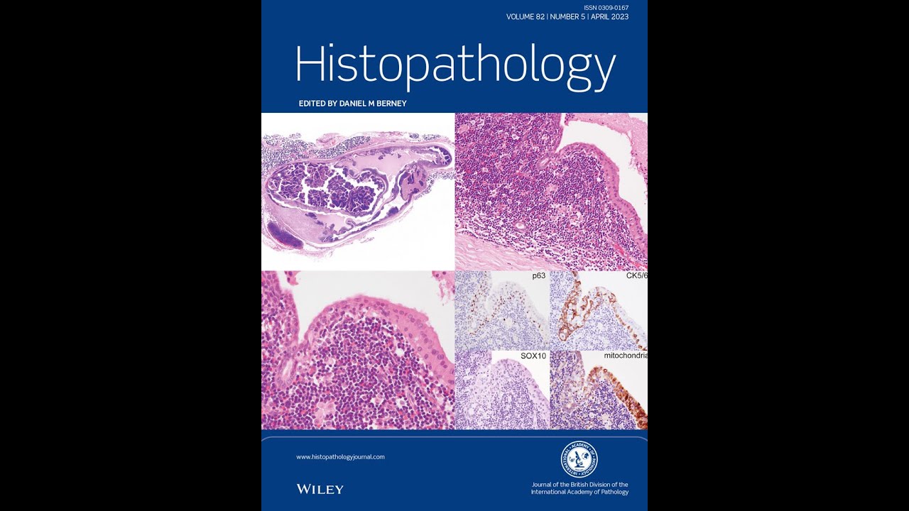 How to do Histopathology / Cytology / FNAC reporting in PathoGoldCloud, Cloud LIMS, Lab Software ...