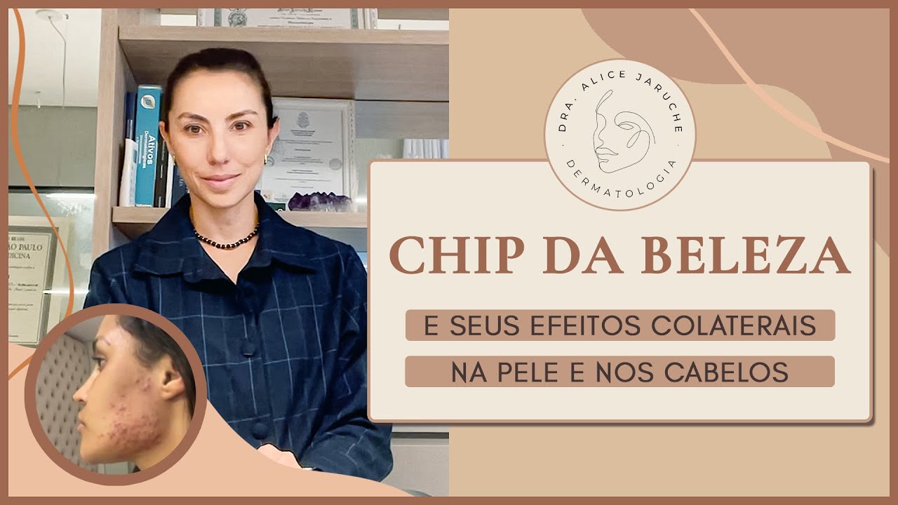 CHIP DA BELEZA | E seus efeitos colaterais na pele e nos cabelos - Dra ...