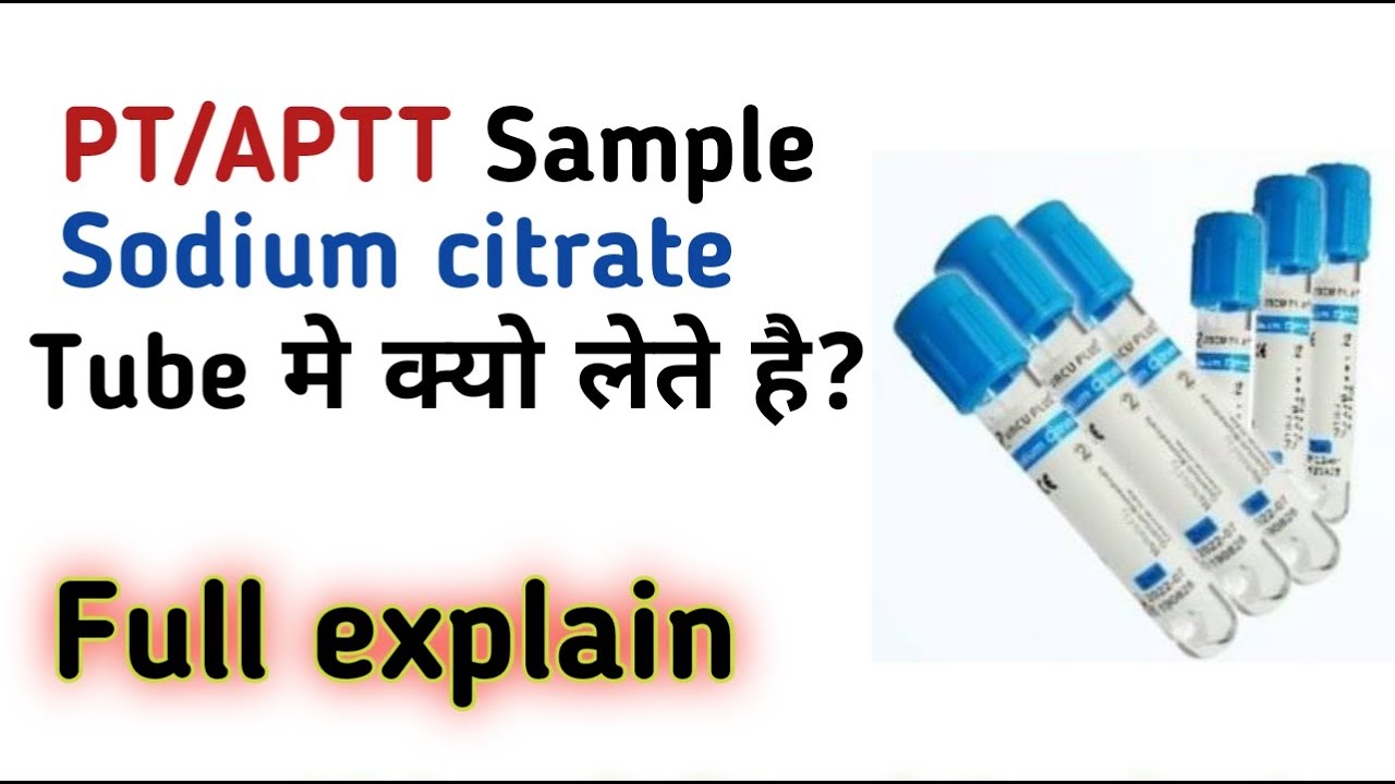 Pt Ptt Inr Lab Values