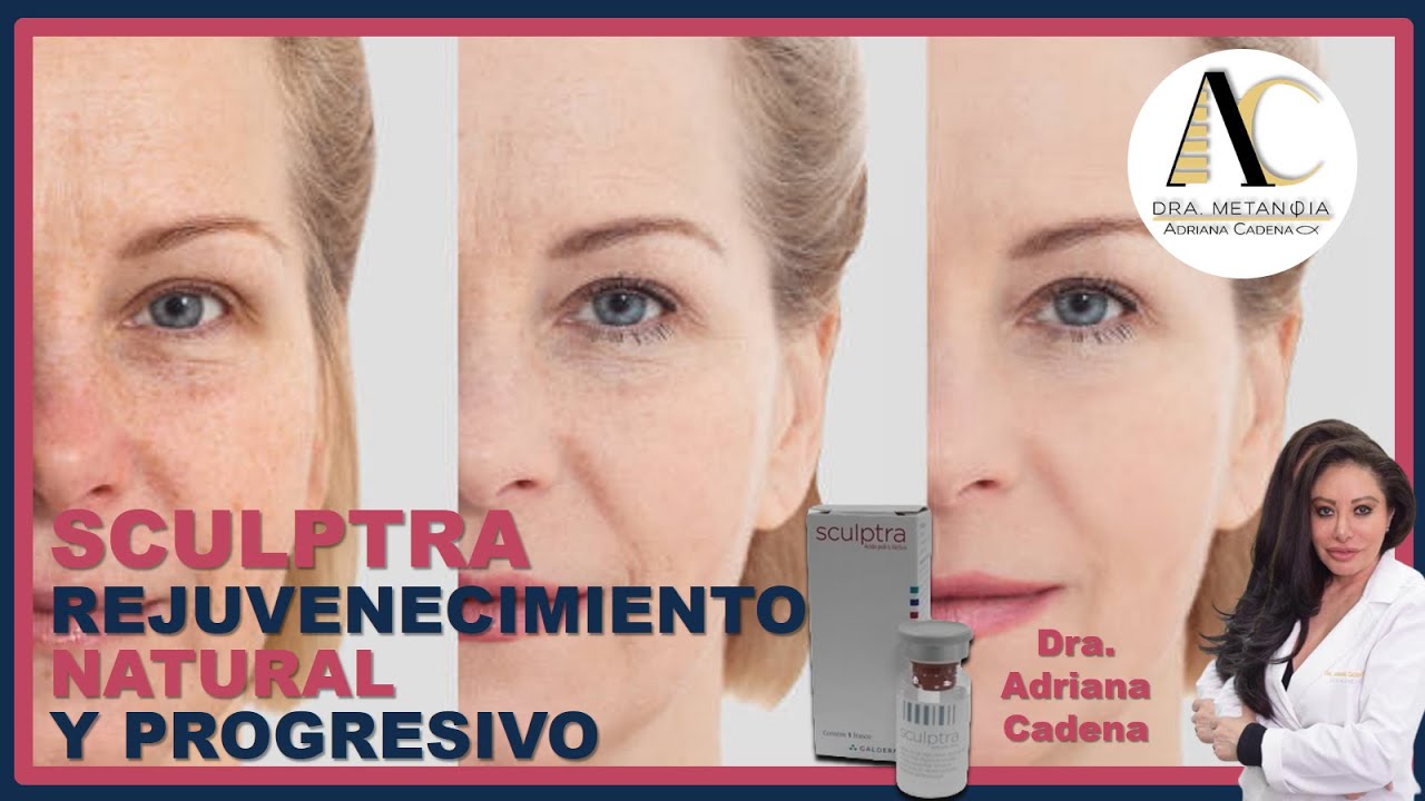 #SCULPTRA LO MÁS NATURAL PARA EL REJUVENECIMIENTO PROGRESIVO - YouTube