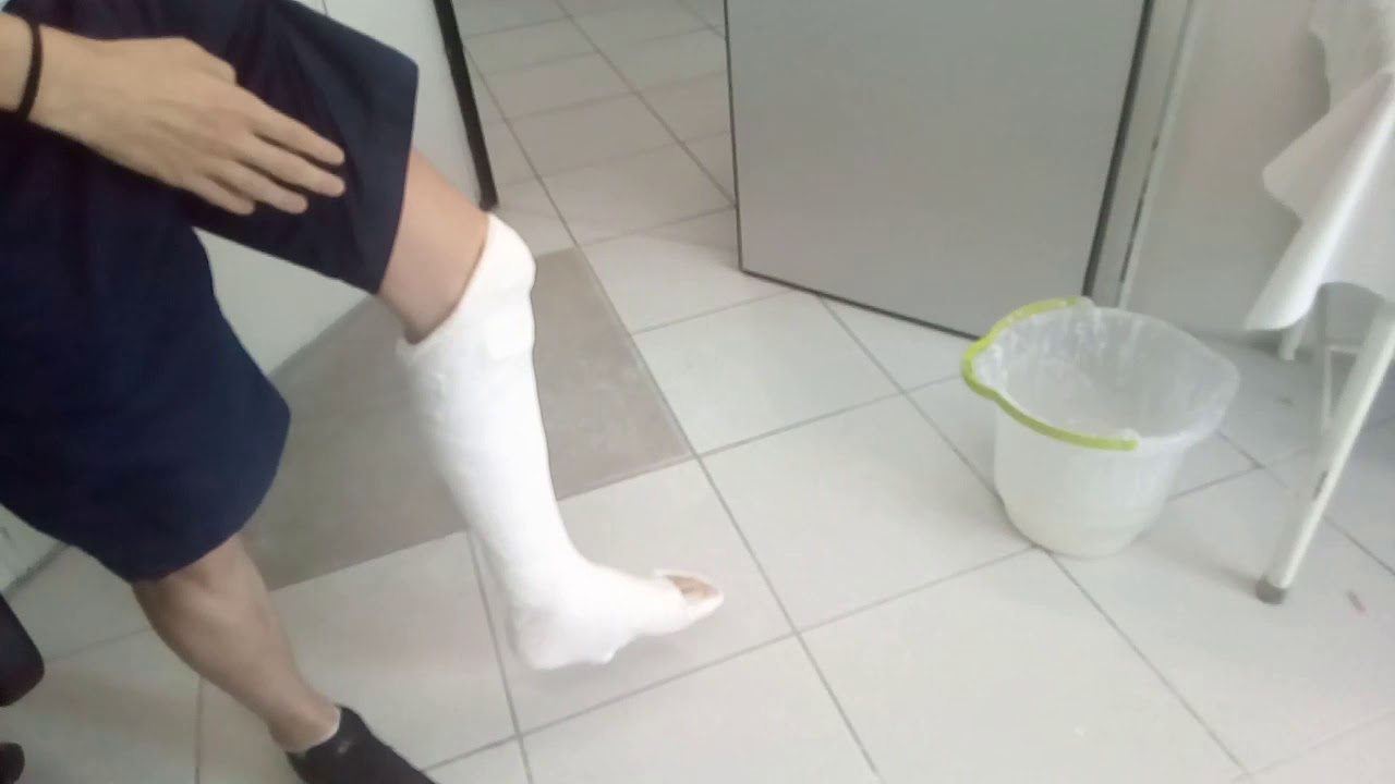 Andando com o gesso PTB na sala de aula - YouTube