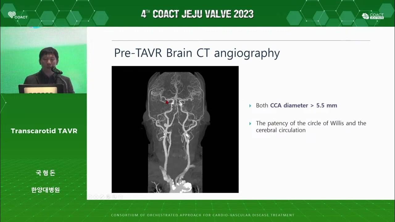 SKY 2023 JEJU VALVE 4-2 : Transcarotid TAVR 국형돈 - YouTube