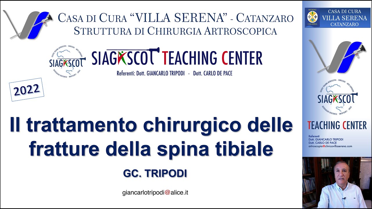Il Trattamento Chirurgico delle Fratture della Spina Tibiale - YouTube