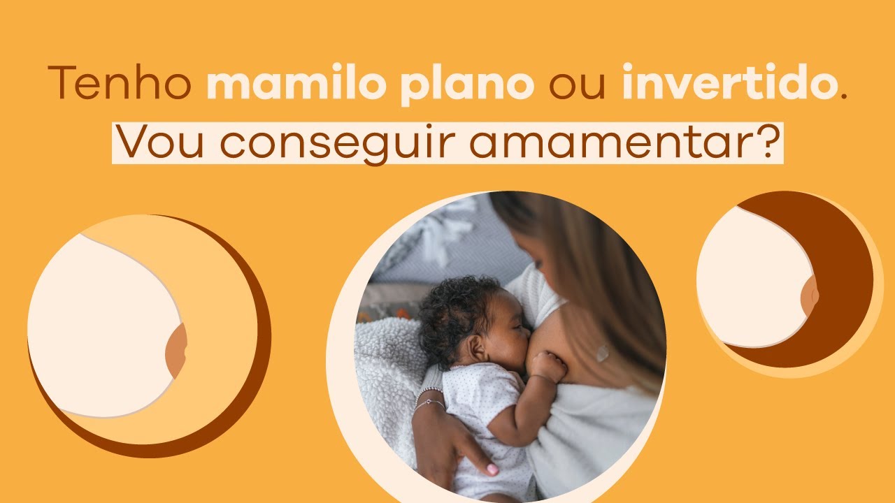Tenho mamilo plano ou invertido.Vou conseguir amamentar? - YouTube
