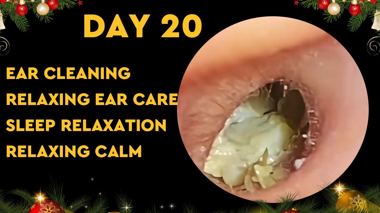 Era of Earstone: Sediment No.9 | Gentle Ear Cleaning With Relaxing ...