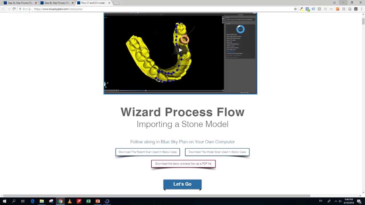 Model Scan Surgical Guides (Everything Blue Sky Plan - Part 2) - YouTube
