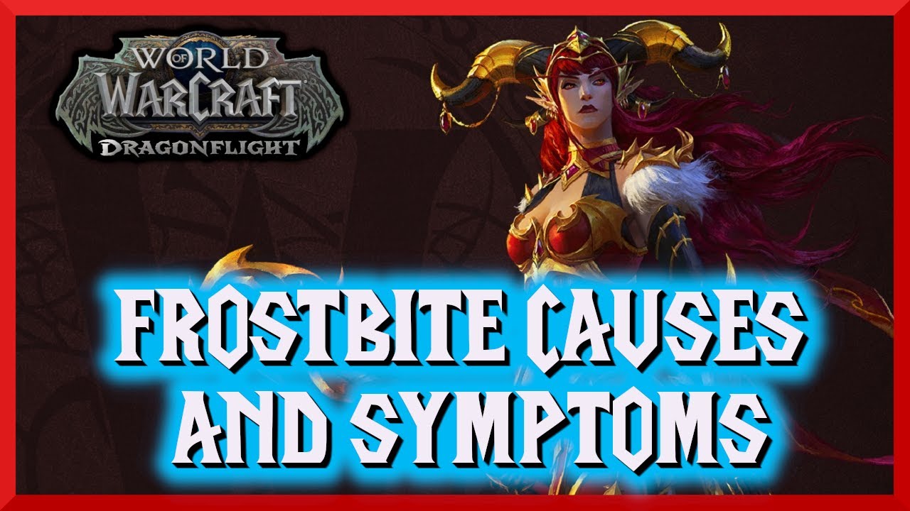 Frostbite: Causes And Symptoms - World of Warcraft : Dragonflight - YouTube