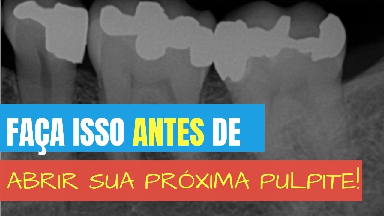 FAÇA ISSO ANTES DE ABRIR SUA PRÓXIMA PULPITE SE QUISER FIDELIZAR SEU ...