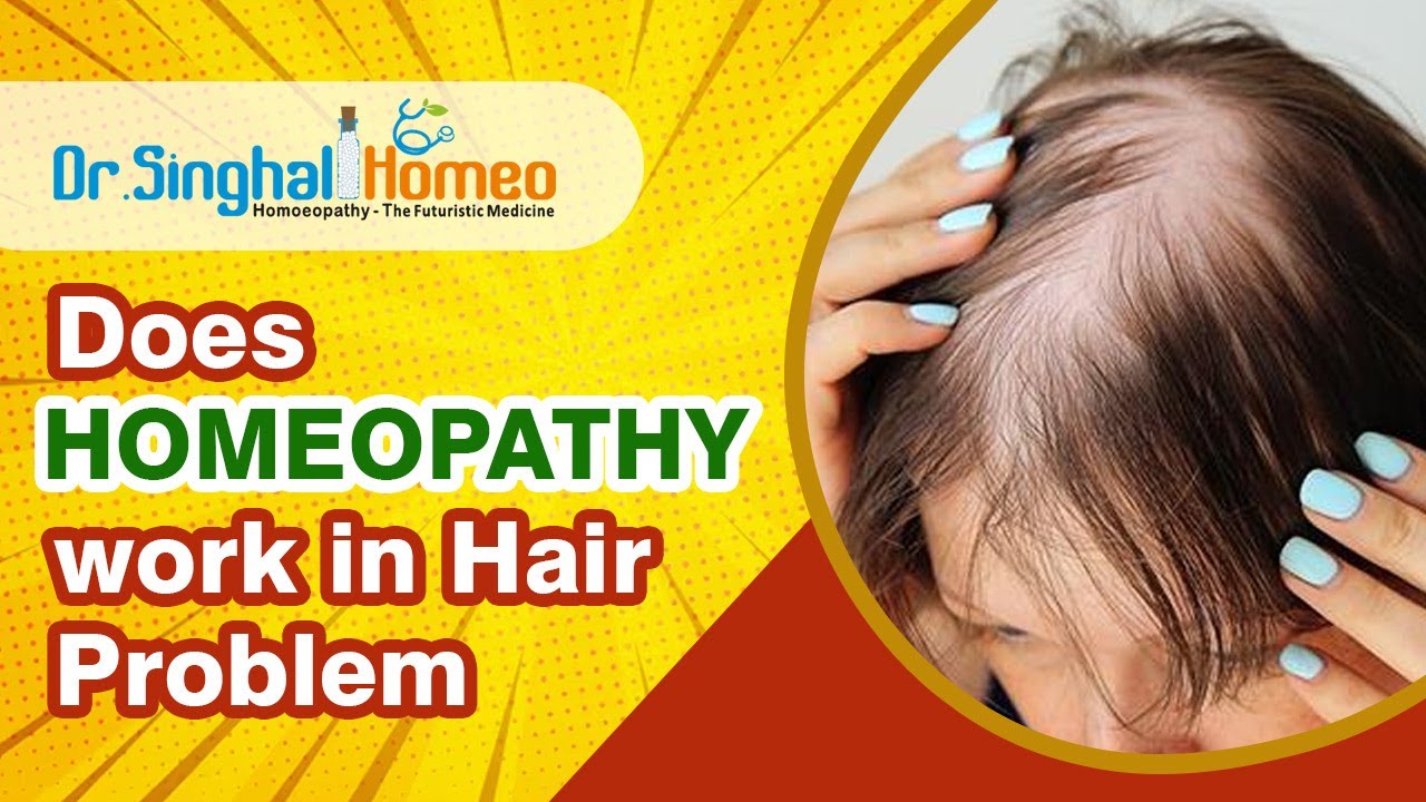 Homeopathy | Hair Fall, Dandruff & Alopecia Treated Naturally – Dr ...