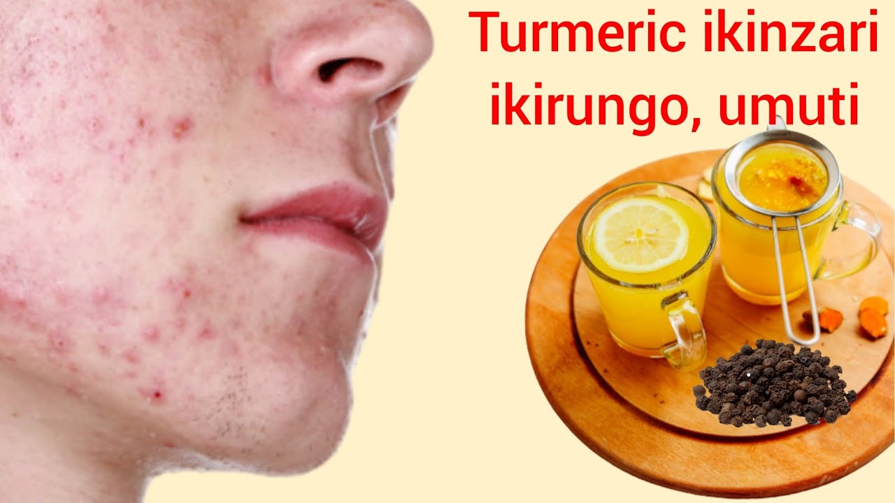 Umumaro wa turmeric (Ikinzari) ku buzima.. umuti w'uruhu, irinda imitsi ...
