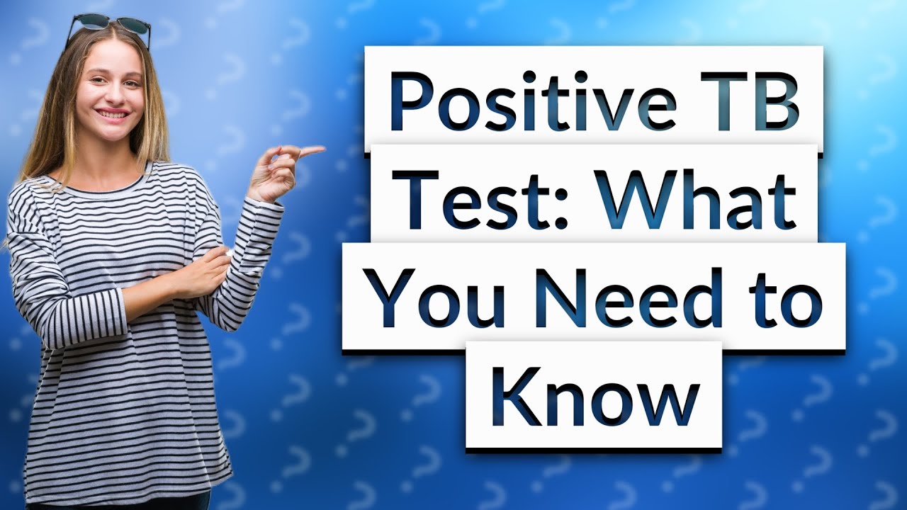What Happens If TB Test Is Positive YouTube what-happens-if-tb-test-is-positive-youtube
