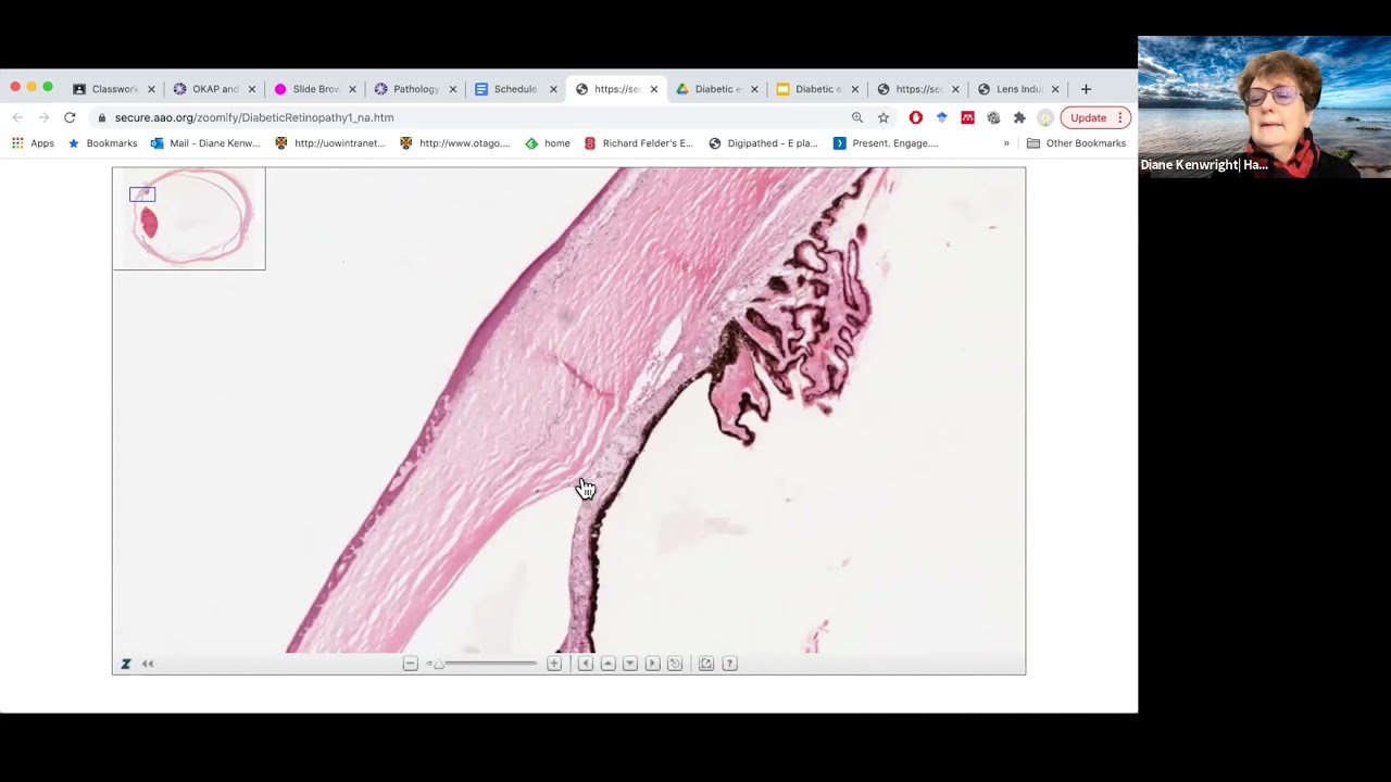 1 August part 2 - YouTube