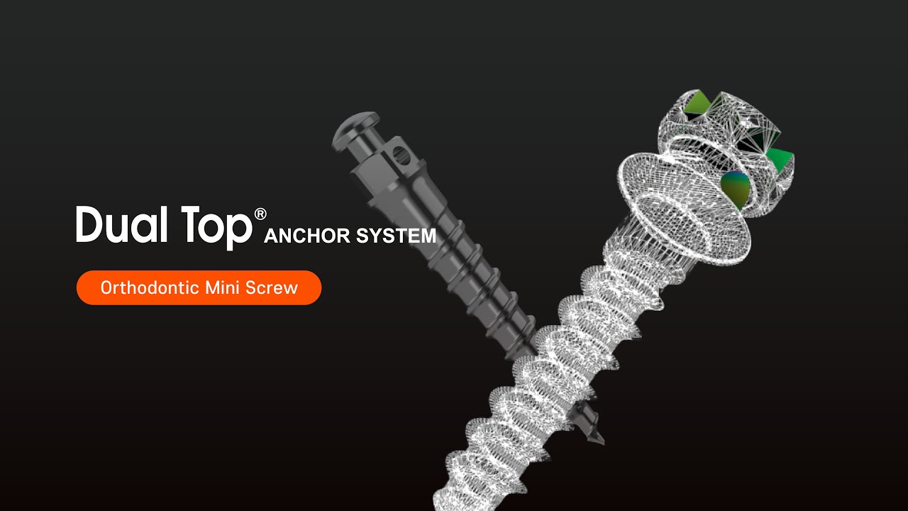 [DUAL TOP] Dual Top Anchor System - Orthodontic Mini Screw - YouTube