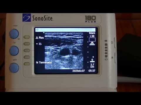 Sonosite 180 Plus