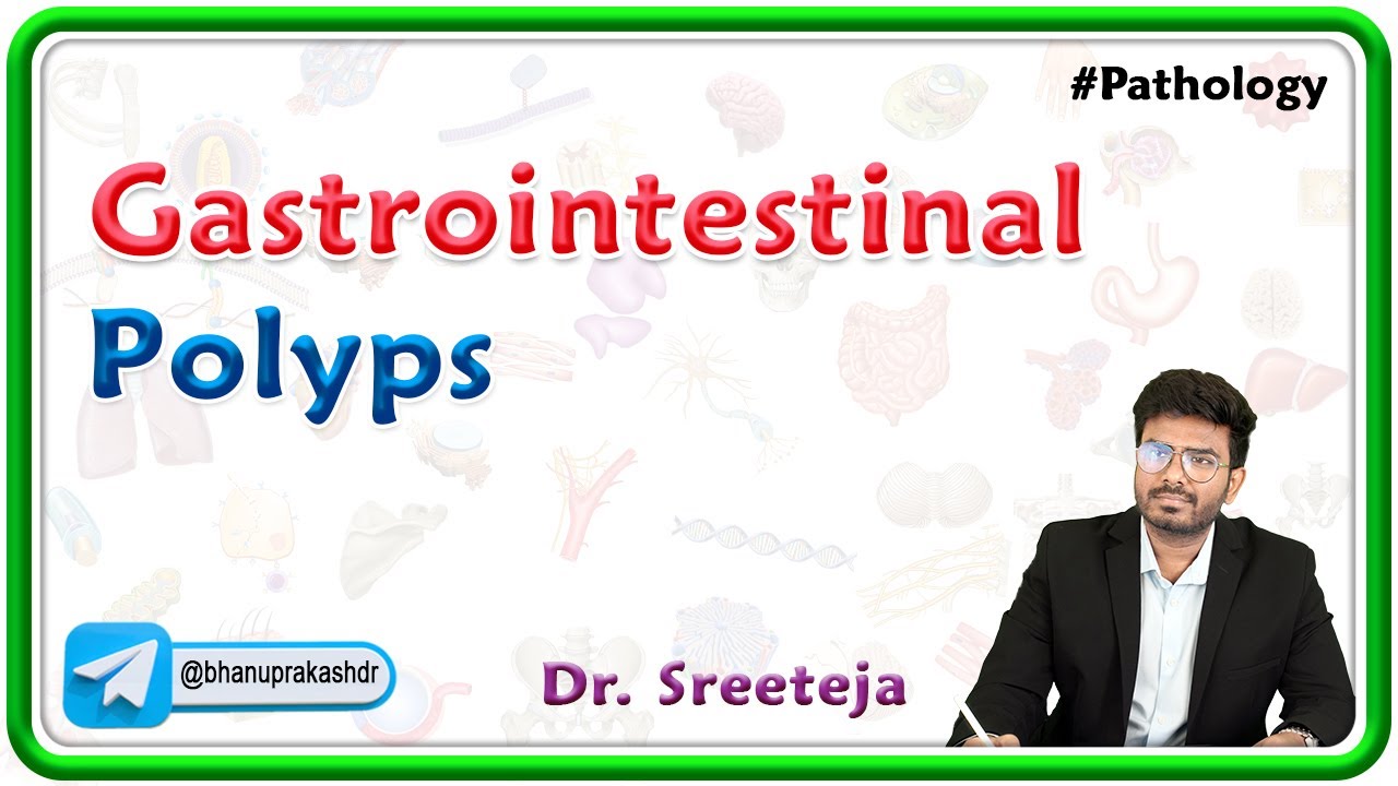 12. Gastrointestinal Polyps | USMLE Step 1 Pathology - YouTube