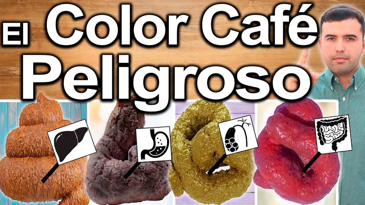 EL PEOR COLOR ES EL CAFÉ! - El Color De Tus Heces Indica Enfermedades ...