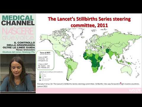 Riduzione dei movimenti fetali - Elisa Montaguti