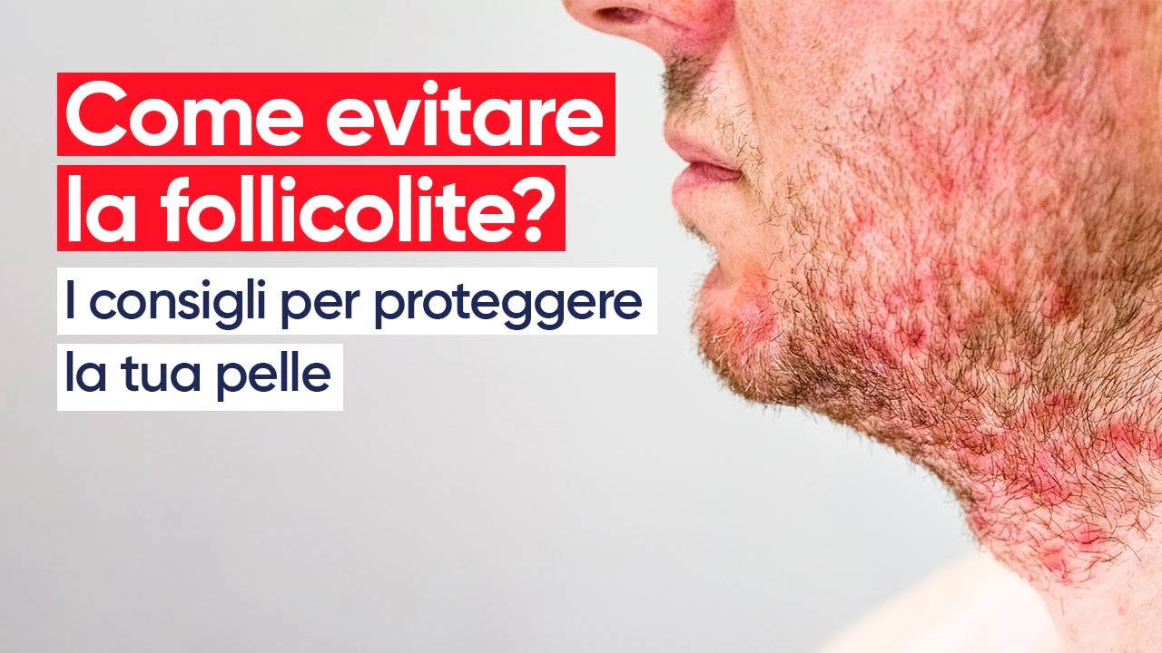 Come evitare la follicolite? I consigli per proteggere la tua pelle ...