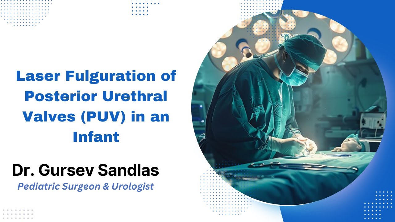 Laser Fulguration of Enlarged Prostatic Utricle - YouTube