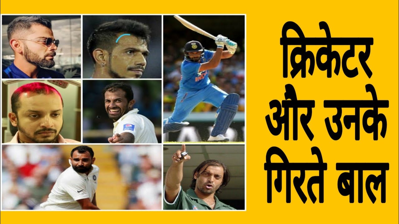 Bald Cricketer Need Best Hair Transplant in World Cup 2019 - YouTube