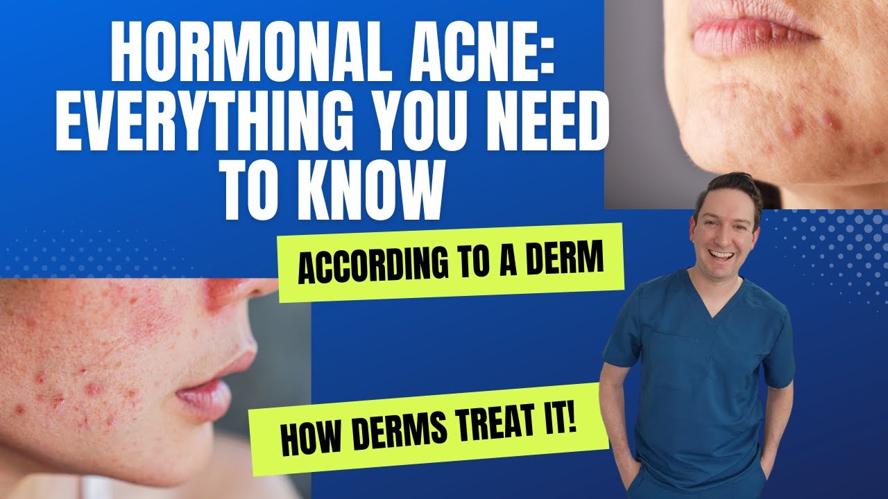 How to tell if you have HORMONAL Acne? #dermatologist #hormonalacne # ...