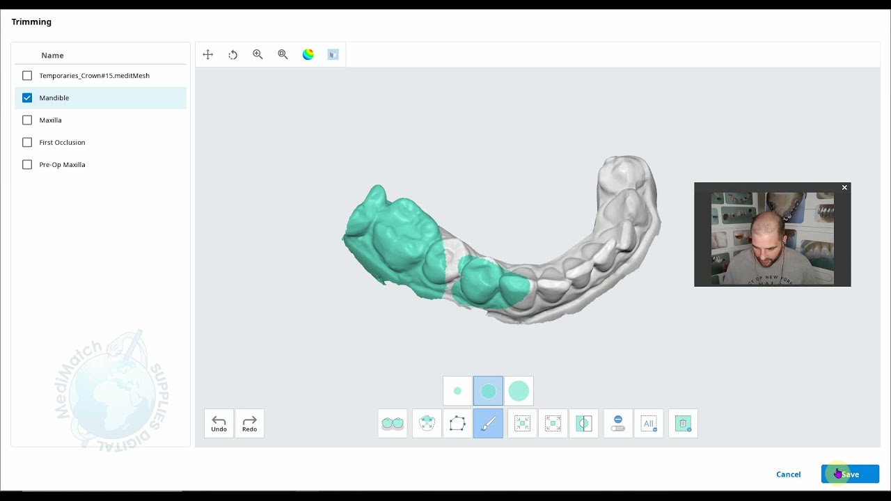 Trimming tools in Medit link fo Clinics - YouTube