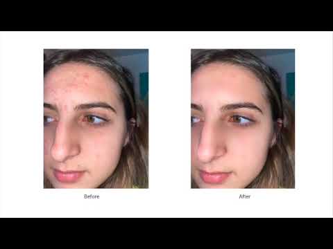 Fabior Foam Commercial - YouTube