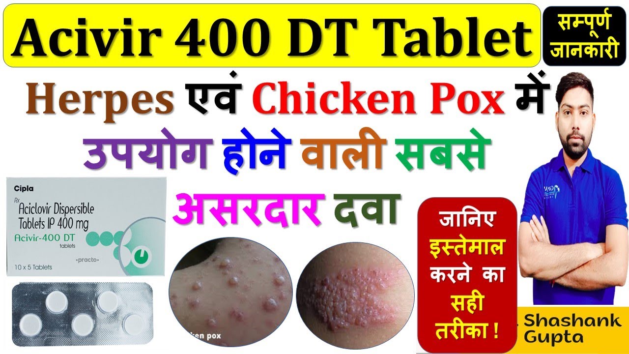 Acivir 400 DT Tablet की सम्पूर्ण जानकारी|Herpes एवं Chicken Pox में ...