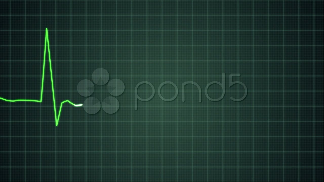 Green Ekg Heart Monitor Goes Flatline (Hd Ntsc). Stock Footage - YouTube