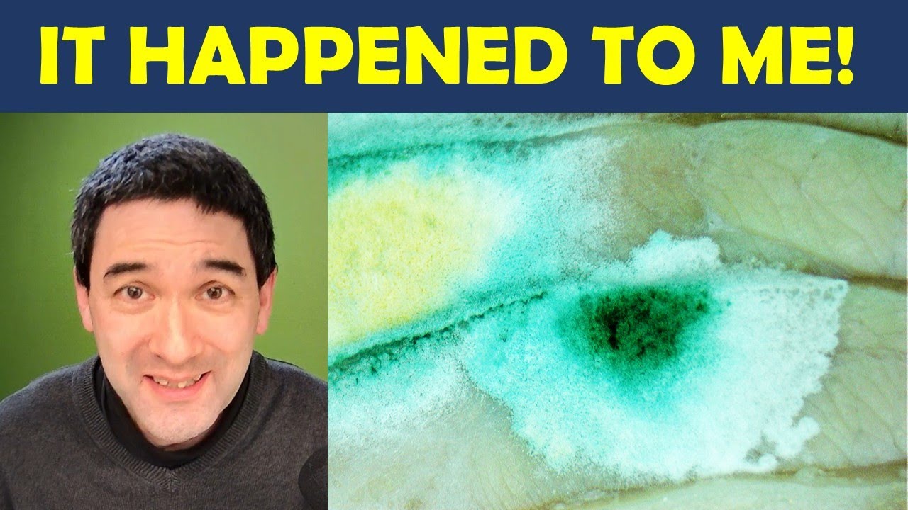 🔬 I Found Moldy Ham In my Fridge! | Here’s What It Looks Like Under the ...