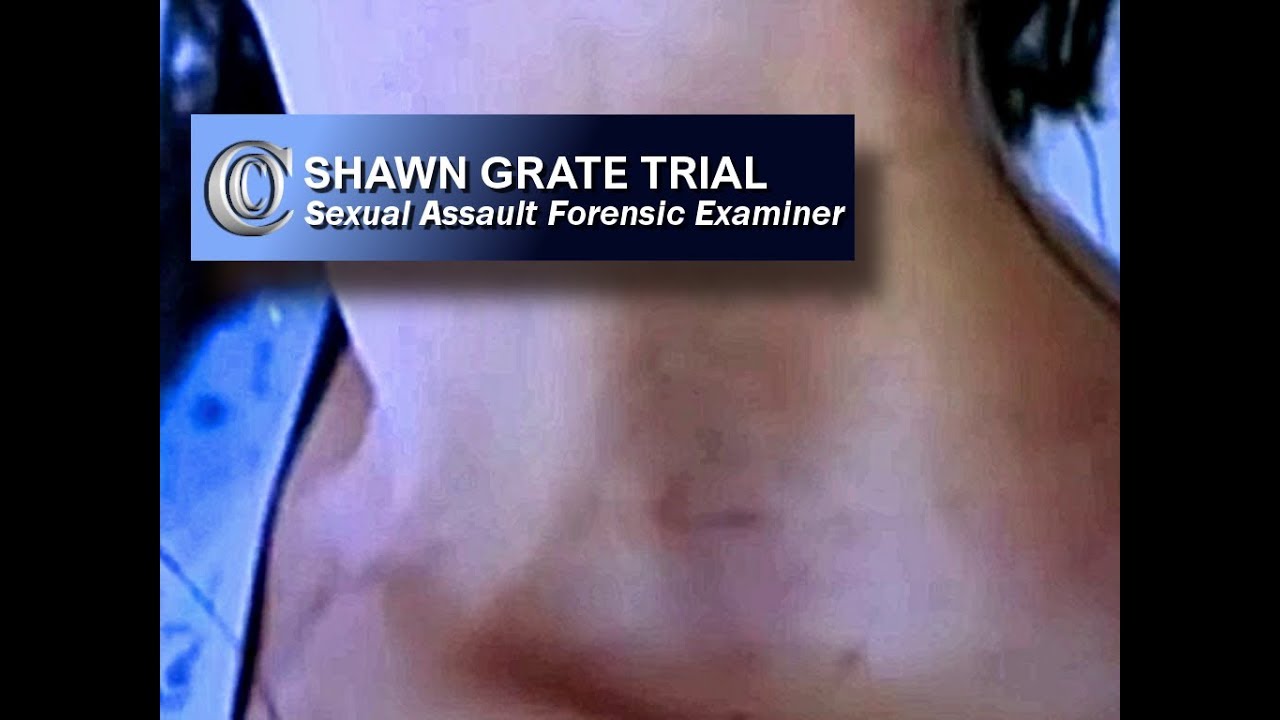 π©ββοΈ Shawn Grate Trial Sexual Assault Forensic Examiner S A F E