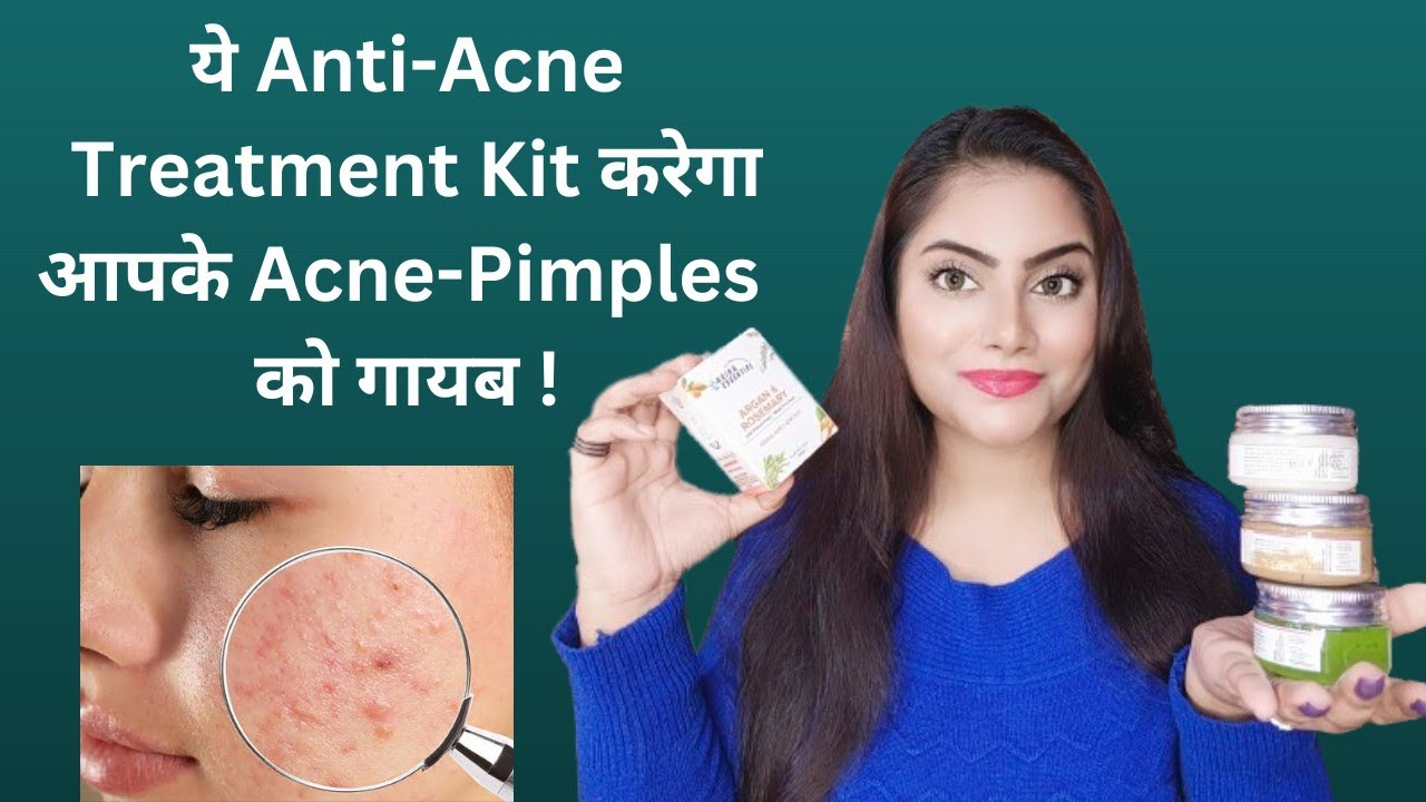 Acne treatment kit review / Acne pimples cream / How to get rid of acne ...