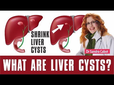 Why Do Cysts Form From Toxins