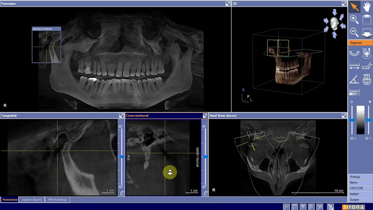 CBCT Basic Image Planes - YouTube