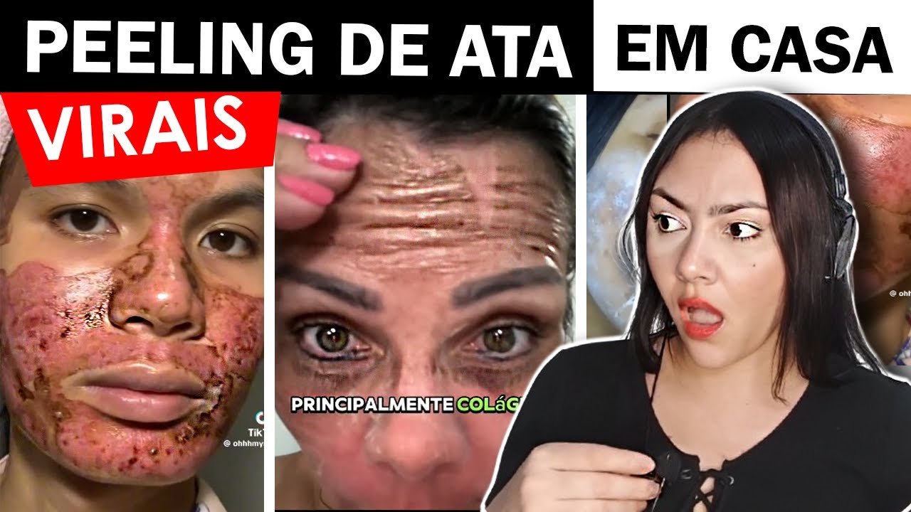 ☠️ Peeling ATA em Casa! 😱 Reagindo a Pessoas Fazendo Peeling Ata #peelingata #react #reagindo ...