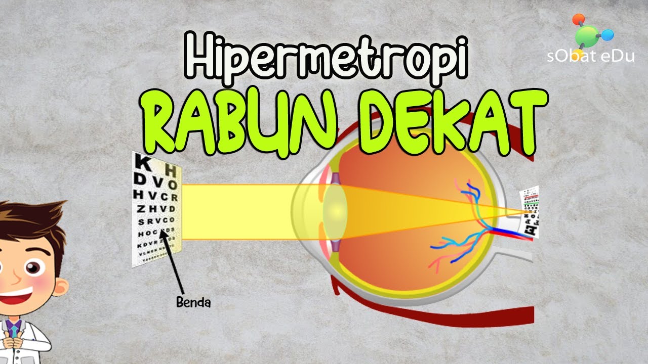 IPA FISIKA : Cacat Mata Hipermetropi atau Rabun Dekat (Simulasi Alat ...