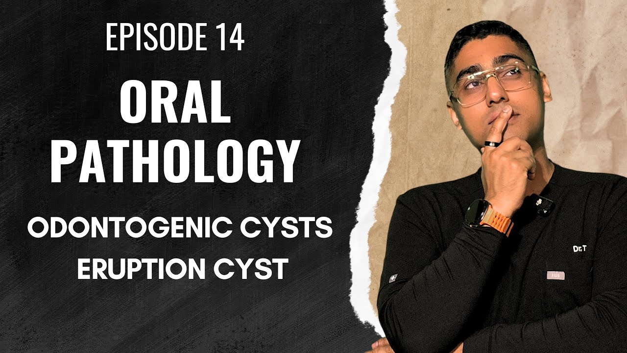 Dental Digest | Oral Pathology | Episode 14 – Eruption Cyst (Eruption ...