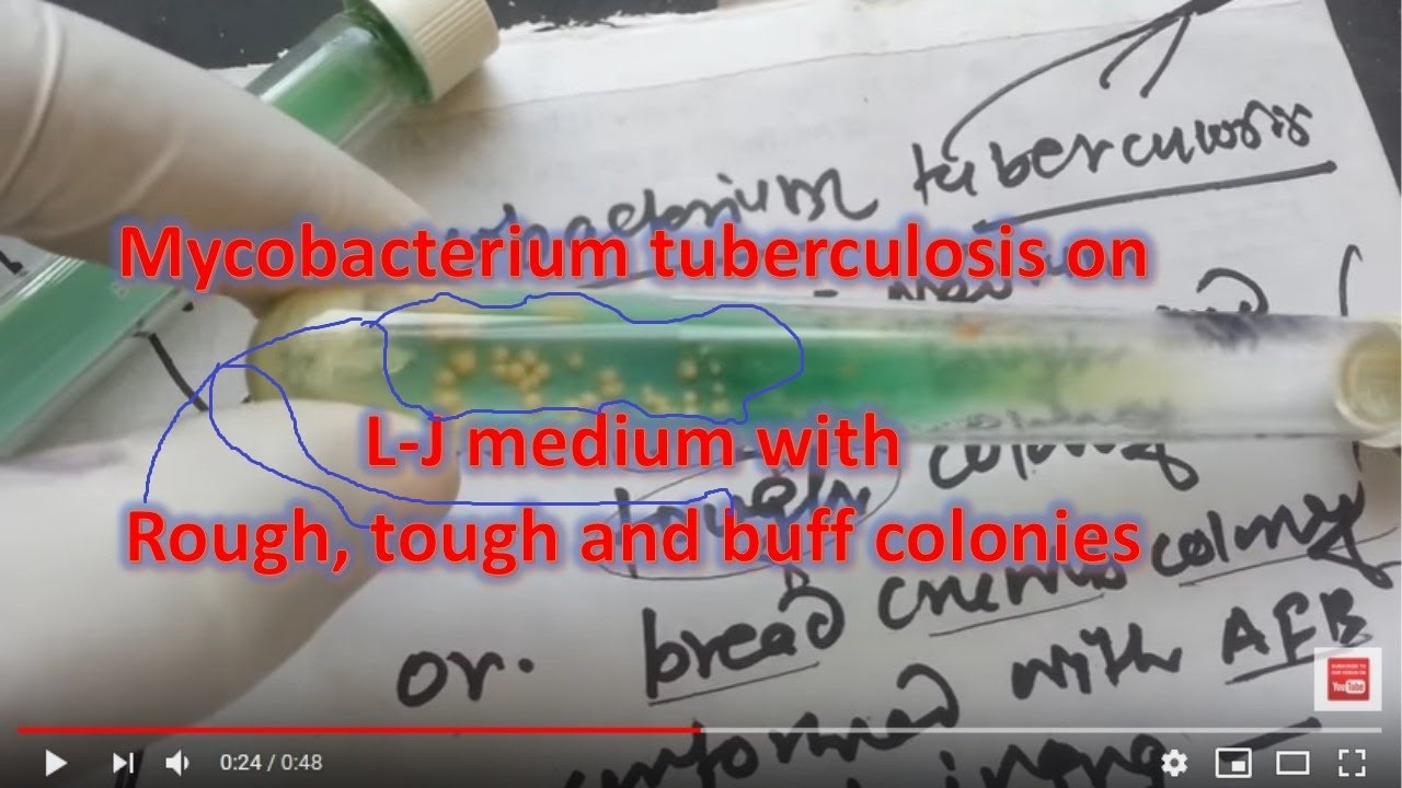 Mycobacterium tuberculosis grown in L J medium - YouTube