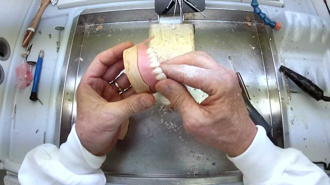 PROTESI MOBILE - YouTube