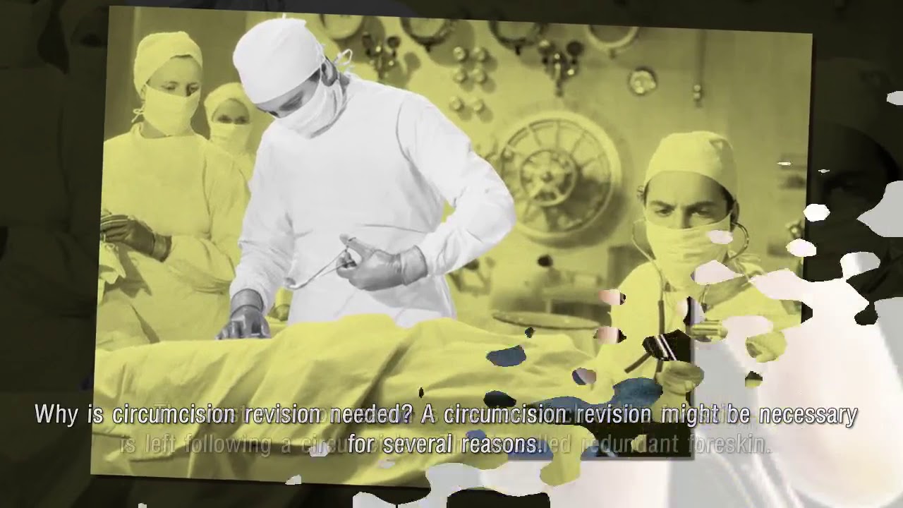 Circumcision Revision| Curi Chan - YouTube