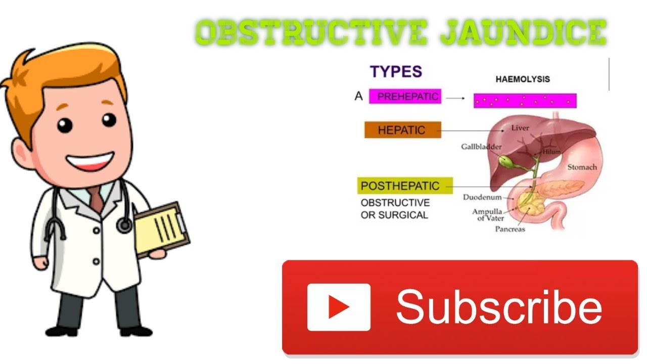 Obstructive jaundice - YouTube
