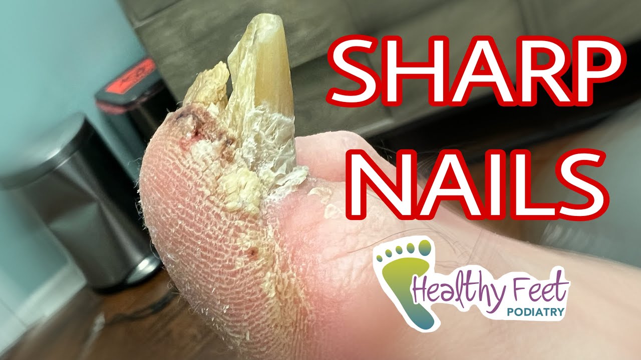 Sharp Nails - YouTube