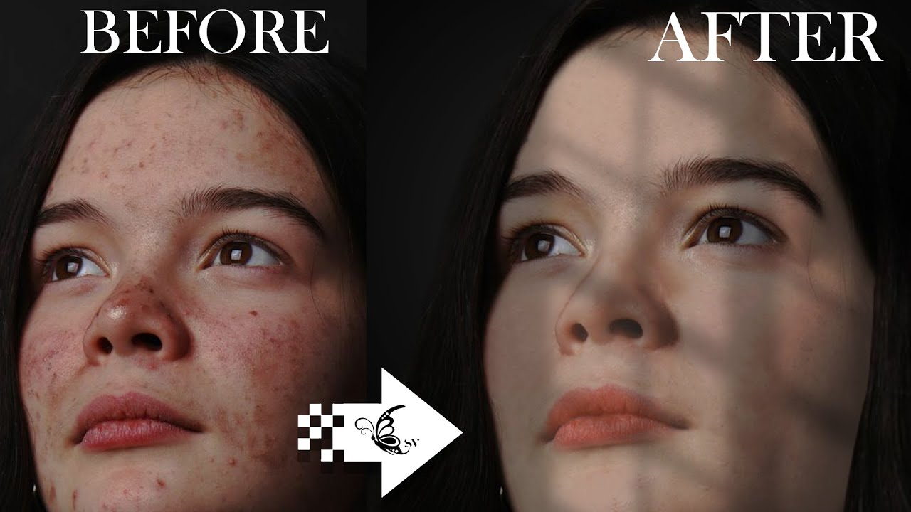 how to remove pimples in photoshop//acne remove//face retouching//your ...