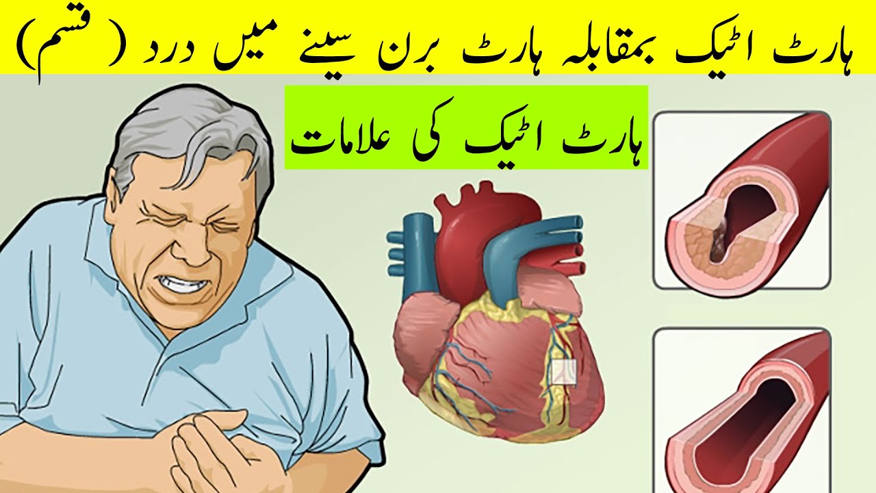 Heart Attack Symptoms | Heart Attack vs Heart Burn Chest pain (Types ...