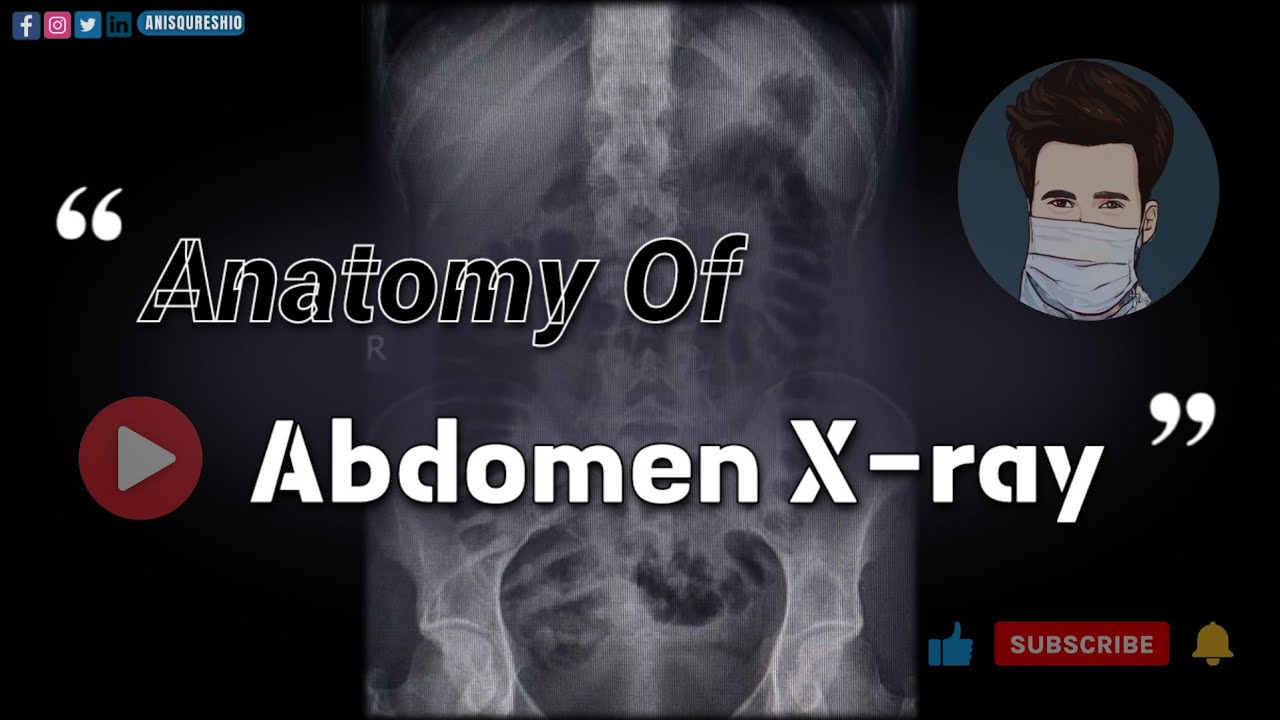 Anatomy of Abdomen Pelvis X-ray | By Anis Qureshi - YouTube