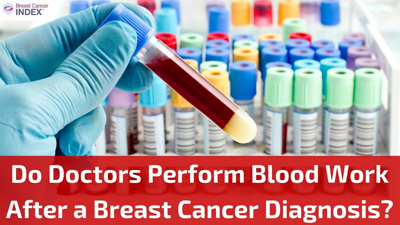 Do Doctors Perform Blood Work After a Breast Cancer Diagnosis? - YouTube