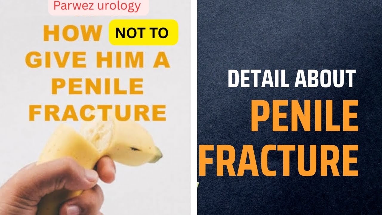 PENILE FRACTURE || WHAT TO DO || BEST MANAGEMENT - YouTube